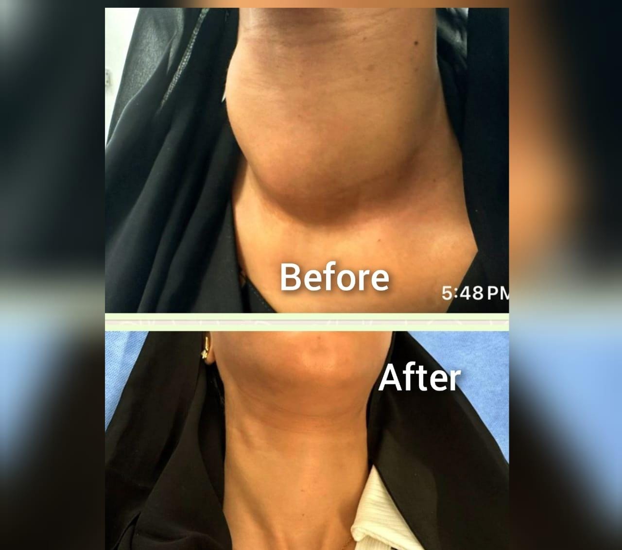 Thyroid Goiter Ablation Center - United Arab Emirates